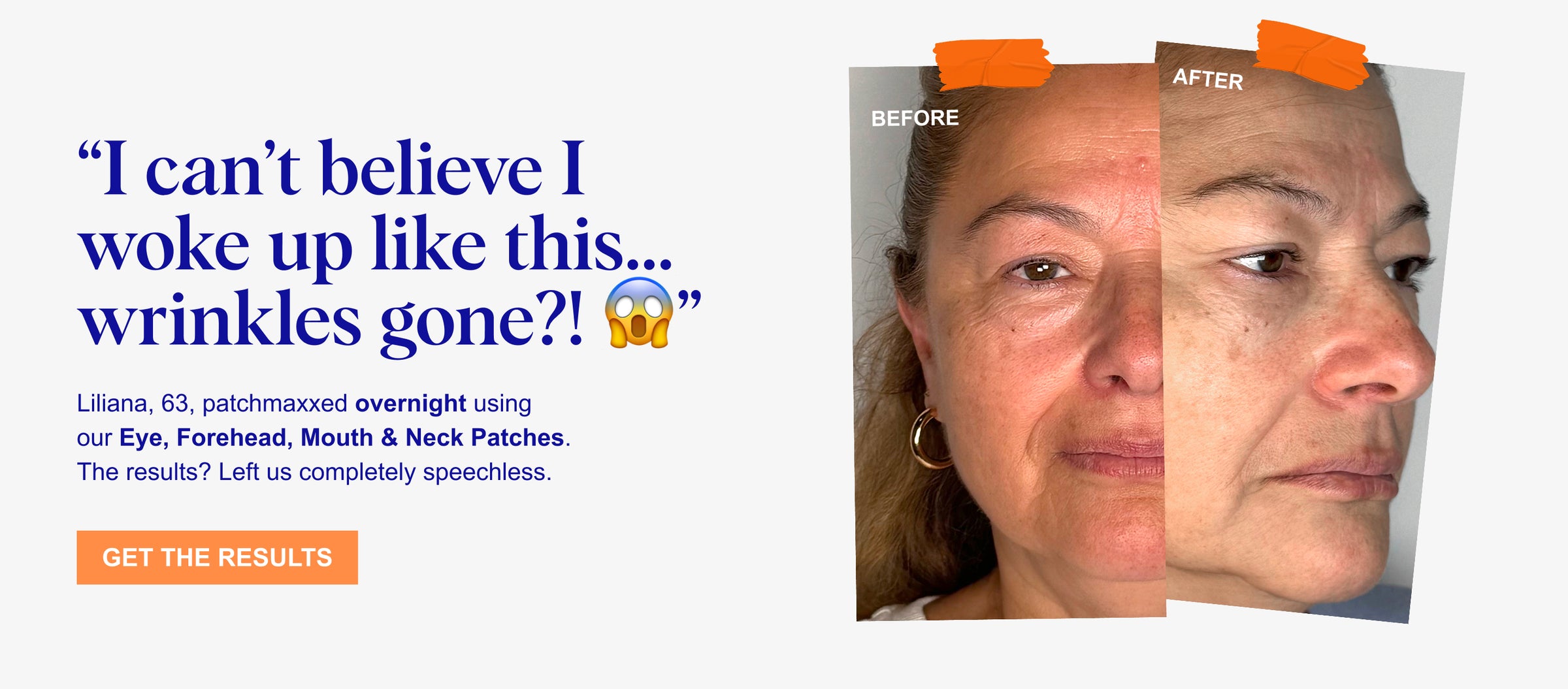 Shop Wrinkles Schminkles | Reusable Silicone Patches for line & wrinkl