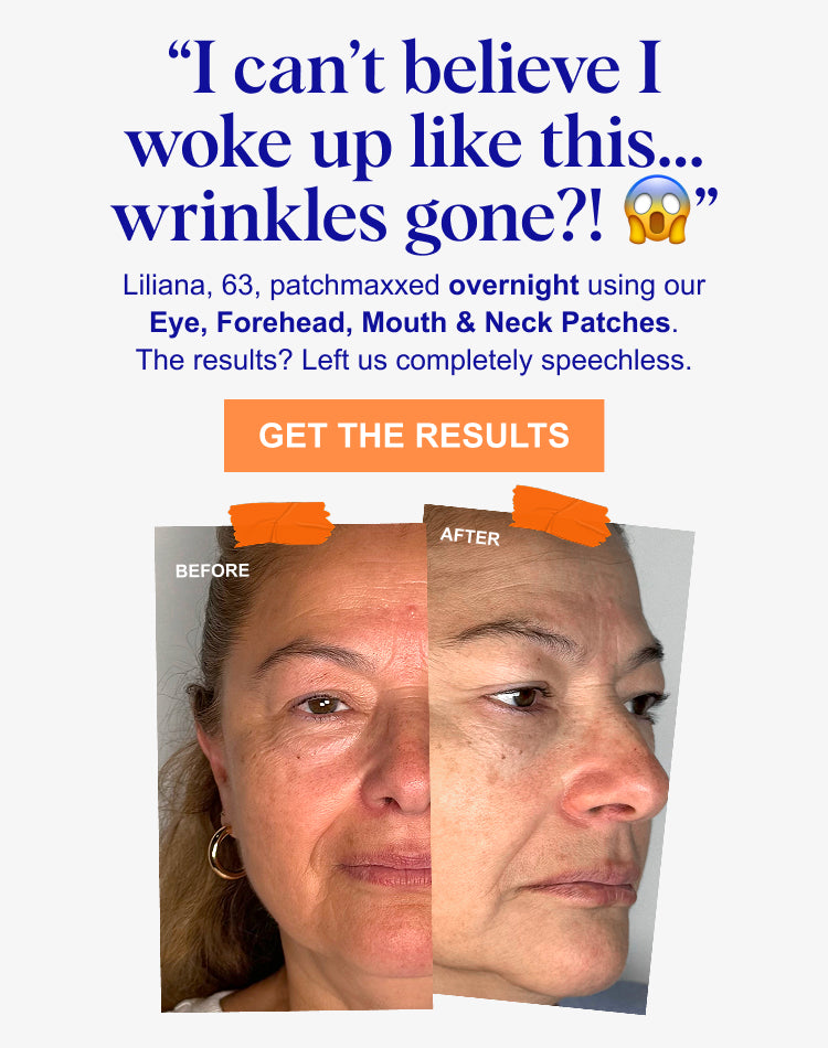 Shop Wrinkles Schminkles | Reusable Silicone Patches for line & wrinkl